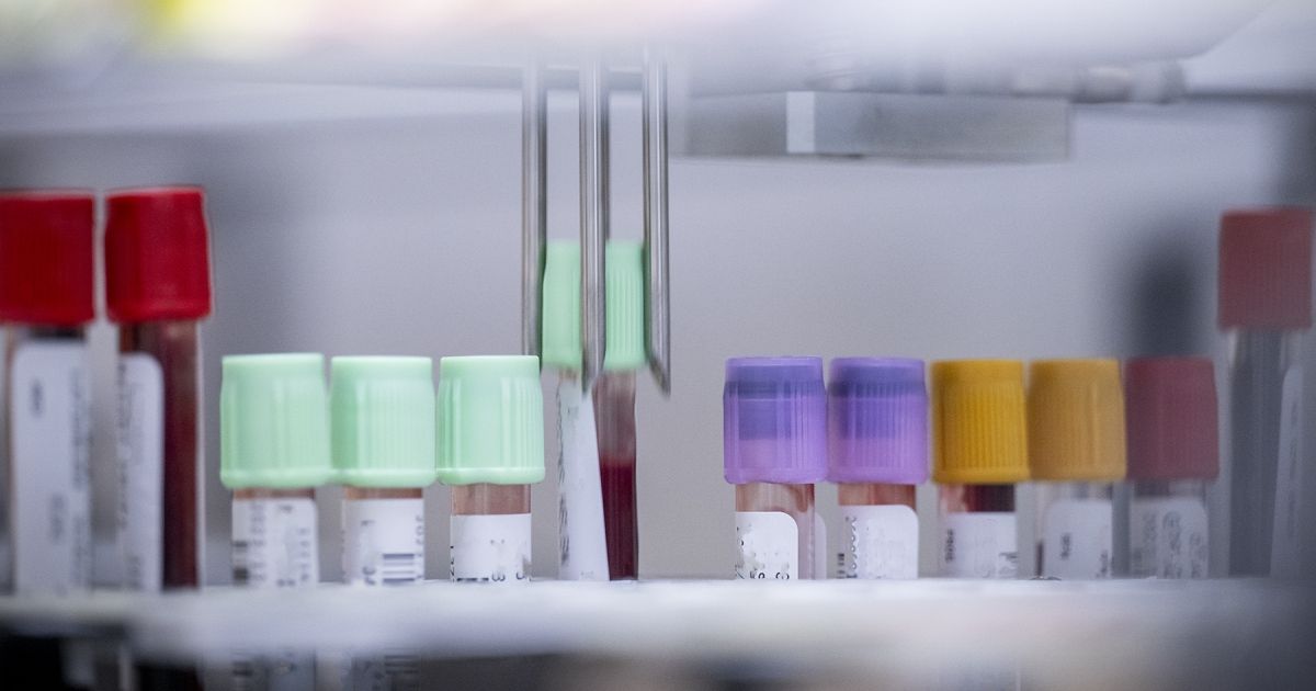 A common-sense approach to bloodwork | KHSC Kingston Health Sciences Centre